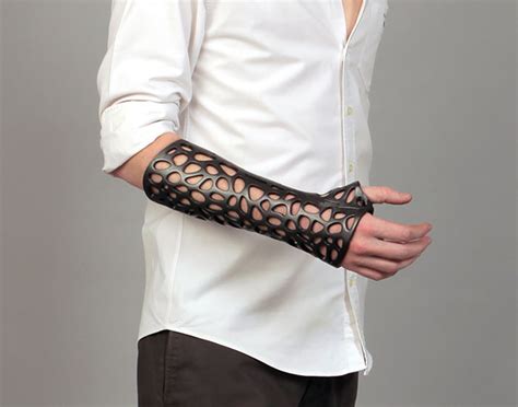 3d Printed Plastic Cast Looks Awesome And Uses Ultrasound To Heal