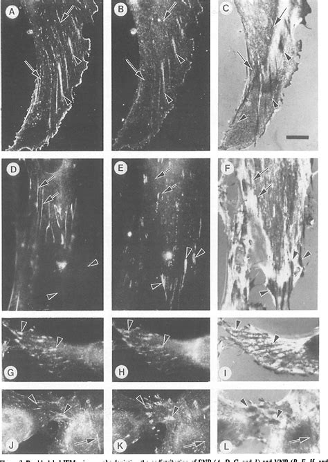 Figure 3 From Cell Surface Distribution Of Fibronectin And Vitronectin