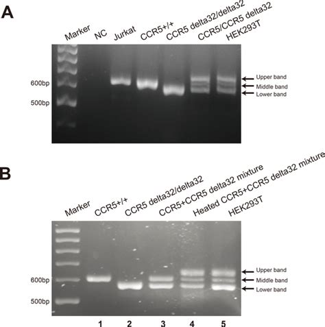 Ccr5 Coreceptor Plos One