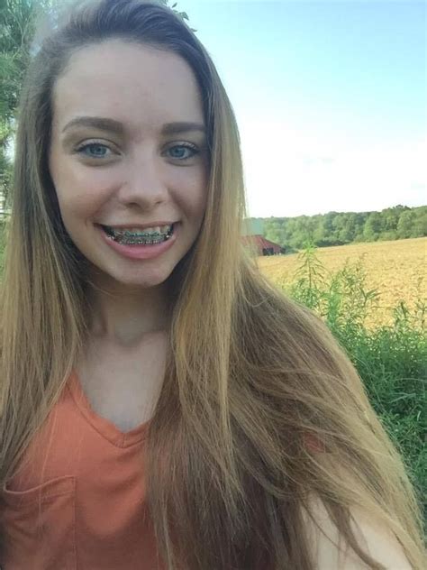 Braces Girls Cute Braces Dental Braces Teeth Braces Alien Aesthetic