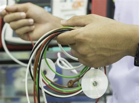 Electrical Cardioversion Cos Cardio