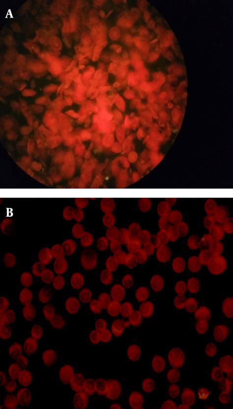A Negative Sample For Human Metapneumovirus Hmpv By Dfa Assay