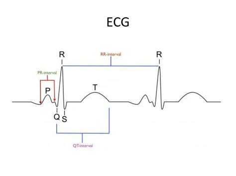 Ppt Qt Interval Powerpoint Presentation Free Download Id5701101