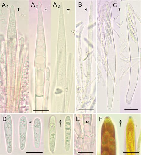 A1 Young Living Paraphysis With Multiguttulate Medium Refractive