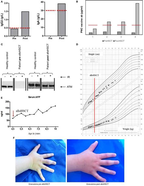 After Allogeneic Hematopoietic Stem Cell Transplantation Allohsct Download Scientific