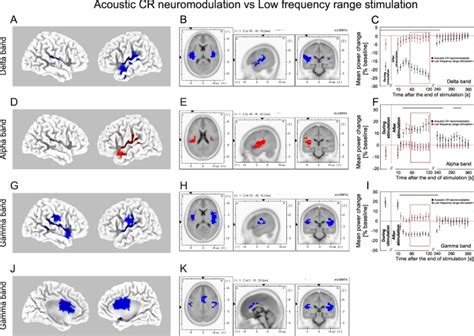 Acute Effects And After Effects Of Acoustic Coordinated Reset Neuromodulation In Patients With