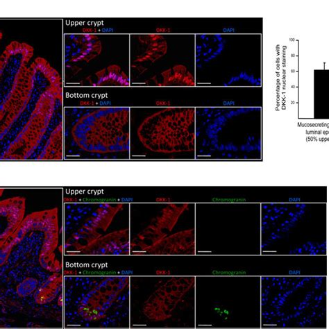 DKK 1 Is Present Within The Nucleus Of Differentiated Human Intestinal
