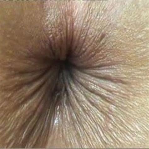 Close Up Butthole Winking Free Butthole Tube Porn Video 4d Xhamster