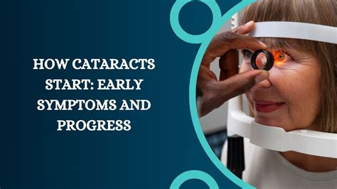 How Cataracts Start Early Symptoms And Progress