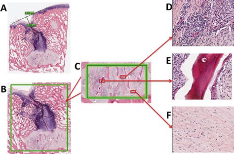 Figure 1 From Novel Osteochondral Biotemplate Improves Long Term