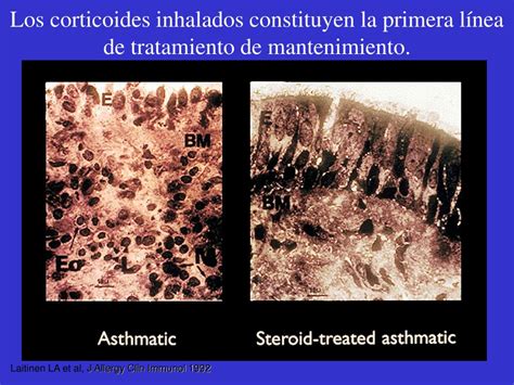 Ppt Avances En El Tratamiento Del Asma Bronquial Powerpoint