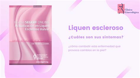 liquen escleroso page Clínica Ginecológica