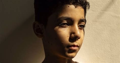 La Imagen De Un Niño Mutilado En Un Ataque En Gaza Foto Del Año Del