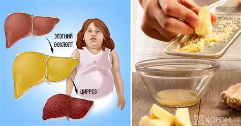 Эмэгтэйчүүдийг элгэндээ онцгой анхаарал хандуулахыг зөвлөж байна Яагаад тийм шаардлагатай вэ гэвэл…