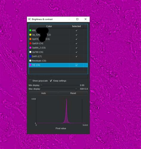 Axioscan Fluorescent Channels Not Displaying In QuPath Image Analysis Image Sc Forum