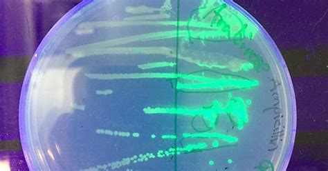 Bacteria With Gfp Green Fluorescent Protein Album On Imgur