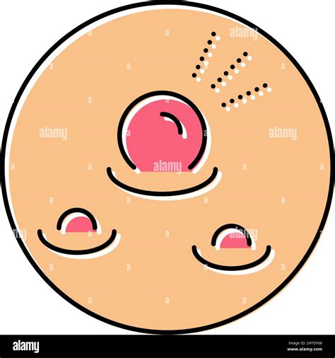 Pyogenic Granuloma Skin Disease Color Icon Vector Illustration Stock