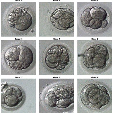 Research On Embryo Grading System Download Scientific Diagram