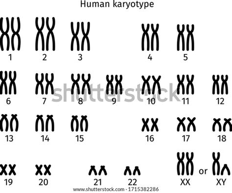 Scheme Normal Karyotype Human Somatic Cell Stock Vector Royalty Free