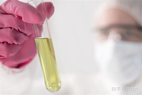 尿白蛋白是什么？怎么看？有什么用？一文说清楚 知乎