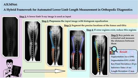 Automatic Lower Limb Length Measurement Network A3lmnet A Hybrid Framework For Automated