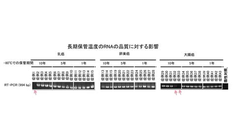 実証データ ⑨ 長期保管温度のrnaの品質に対する影響 一般社団法人 日本病理学会 ゲノム研究用病理組織検体取扱い規程