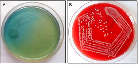Surveillance Of Bacteria Pseudomonas Aeruginosa And Mrsa Associated