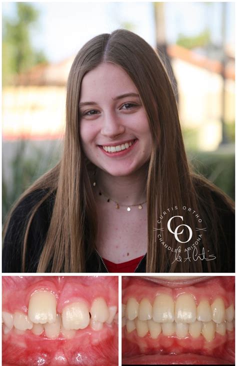 CURTIS ORTHODONTICS Updated June Photos Reviews W Elliot Rd Chandler