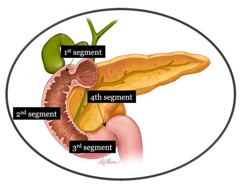 Gastrointestinal Learning Modules Ct Scanning