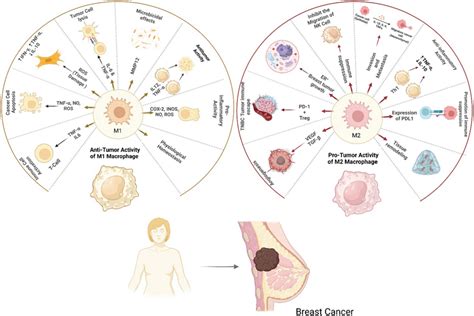 Anti Tumor Pro Tumor Activity Of Macrophages In Breast Cancer