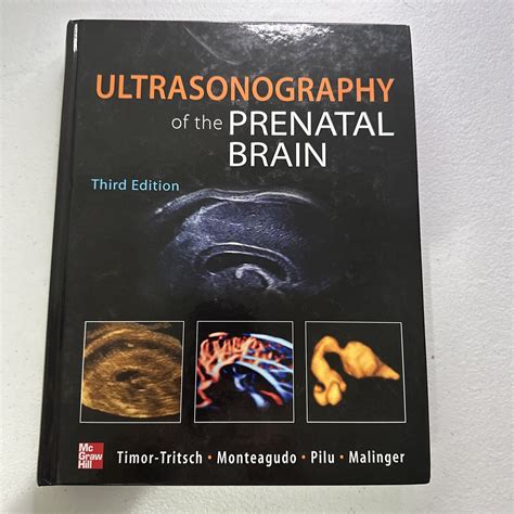 Ultrasonography Of The Prenatal Brain Third Edition By Ana Monteagudo