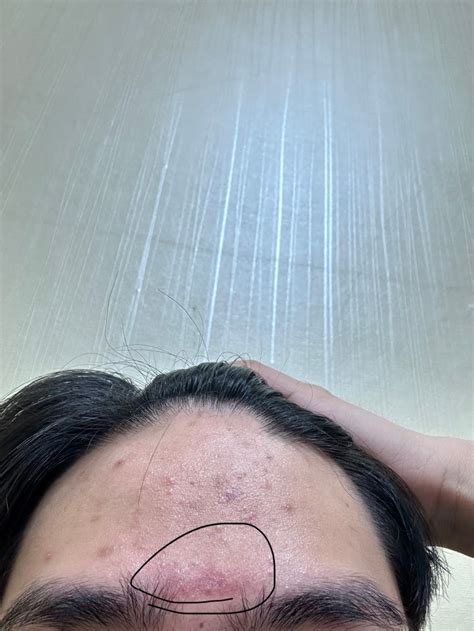 눈섭사이 위에 동그라미 친 부분 지식in