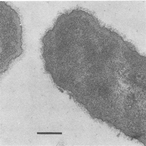 Thin Section Of P Putida Long Ribbon Like Om Material Is Loosening