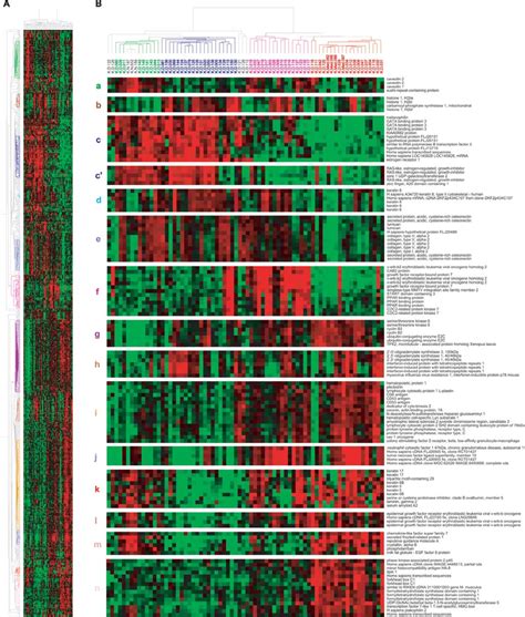 Unsupervised Hierarchical Clustering Of 69 Tumors And 3 Non Malignant