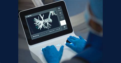 Franciscan Health Michigan City Advances Lung Cancer Program With Ion