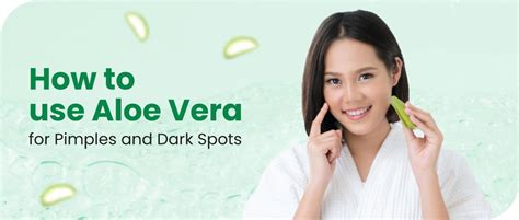 How To Use Aloe Vera For Pimples And Dark Spots