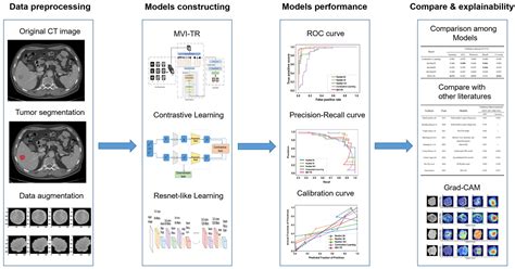 Mvi Tr A Transformer Based Deep Learning Model With Contrast Enhanced Ct For Preoperative