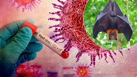 Truenat Nipah Detection Test — Balanced Report