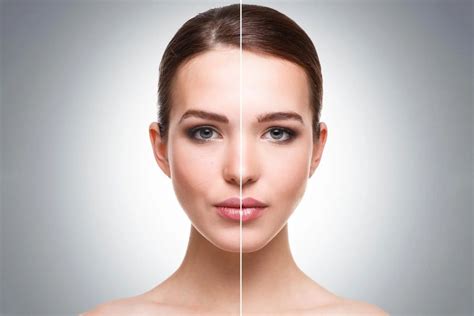 Laser Skin Clinic Ottawa Fotona Laser Treatment Alchemistlaser