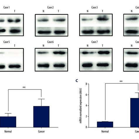 Western Blotting Of The Pi3k Akt Gsk3b B Catenin Signaling A B