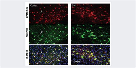Yellow Fever Virus Uc Irvine Center For Neural Circuit Mapping