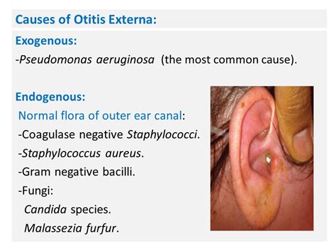 Bacterial Otitis Externa