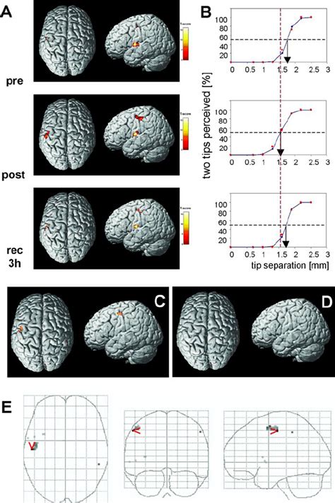 Effects Of Rtms On Bold Signals A Rtms Effect On Bold Signals Of A Download Scientific