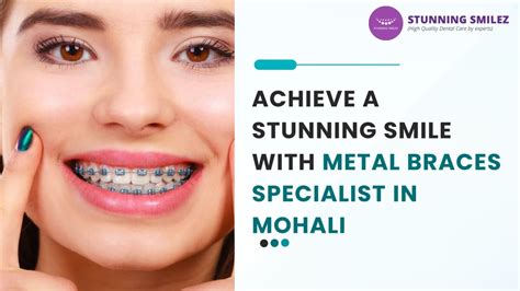 Ppt Achieve A Stunning Smile With Metal Braces Powerpoint