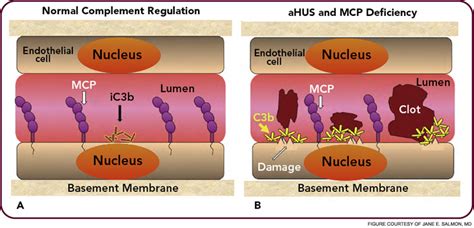 Exploring The Complement System In Human Disease Page 4 Of 7 The Rheumatologist
