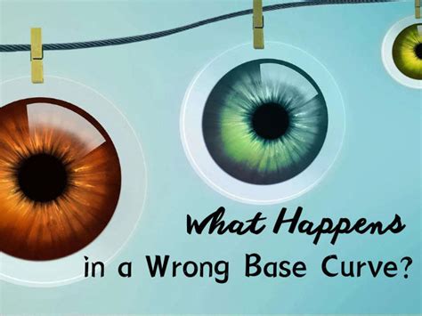 What Are The Wrong Base Curve Symptoms Will It Cause Discomfort Esoeye
