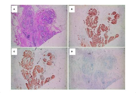 Immunohistochemical Analysis On Mbt Tissue Sections A Testicular Download Scientific