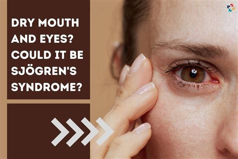 Dry Mouth And Eyes Could It Be Sjögrens Syndrome The Lifesciences
