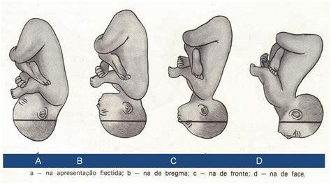 Estudo De Enfermagem Estática Fetal
