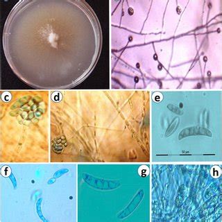 A C Fusarium Oxysporum F Sp Psidii A Macro And Microconidia B